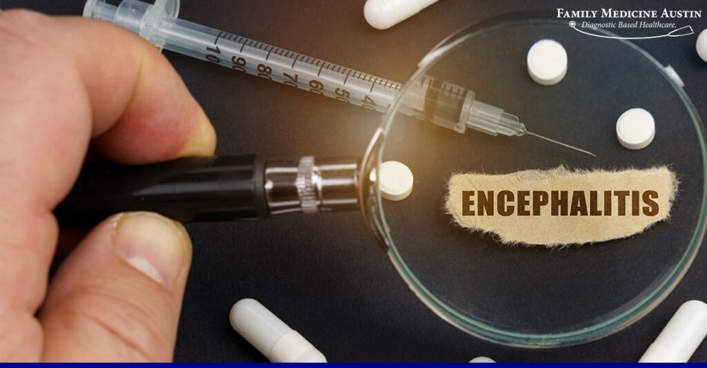 Autoimmune Encephalitis Treatment, Diagnosis & Types | FMA